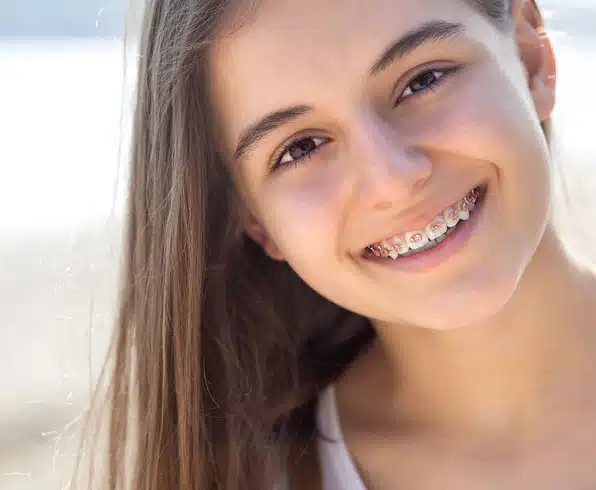 Dental Braces | Victorville, CA | Kelly Smile Dentistry